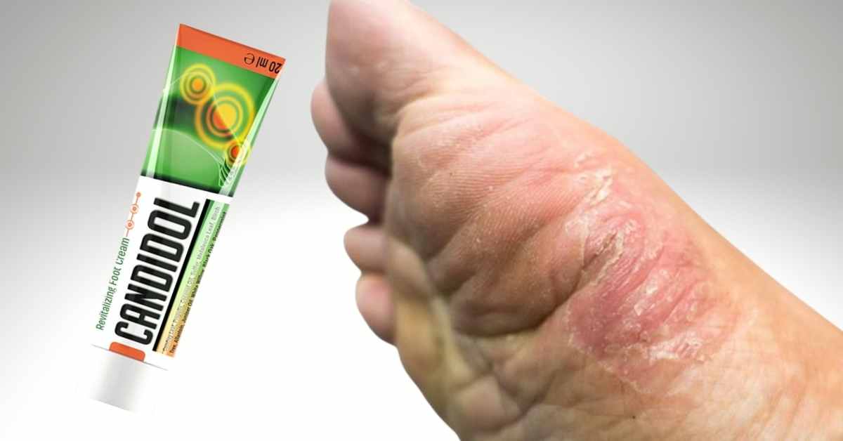 CANDIDOL POLSKA 2020, Opinie, Cena, Gdzie kupić w Polsce, jak korzystać ...